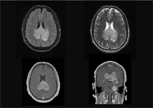 Introducing 3T MR Imaging with the New MAGNETOM Vida