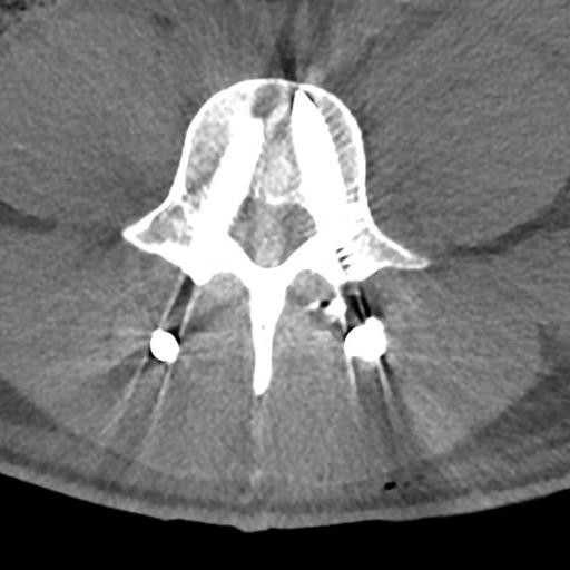 iMAR - Siemens Healthineers