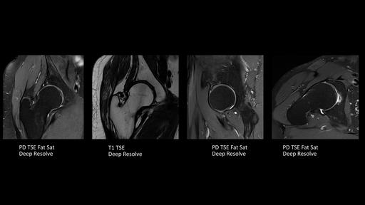 BioMatrix Contour Coils - Siemens Healthineers