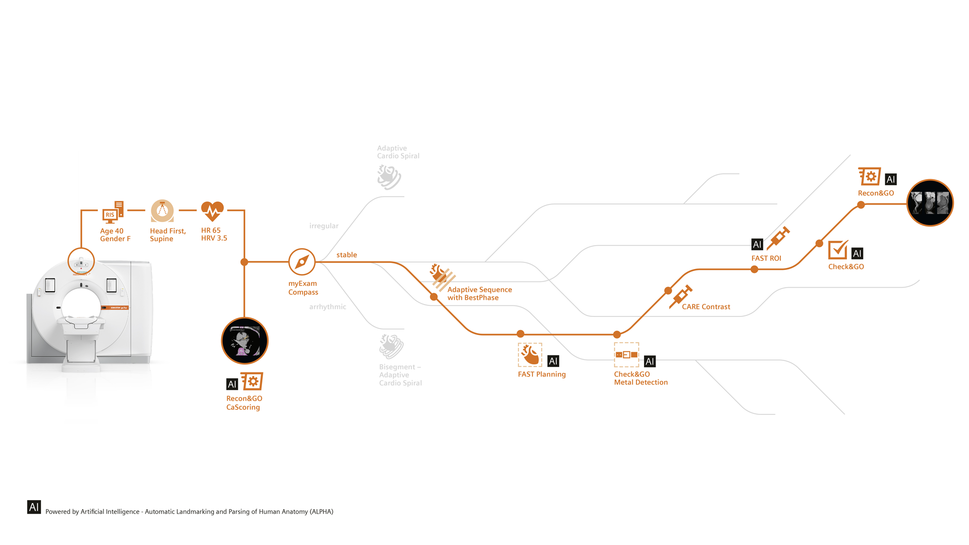 SOMATOM go.Top - AIでワークフローを自動化 - Siemens Healthineers Japan
