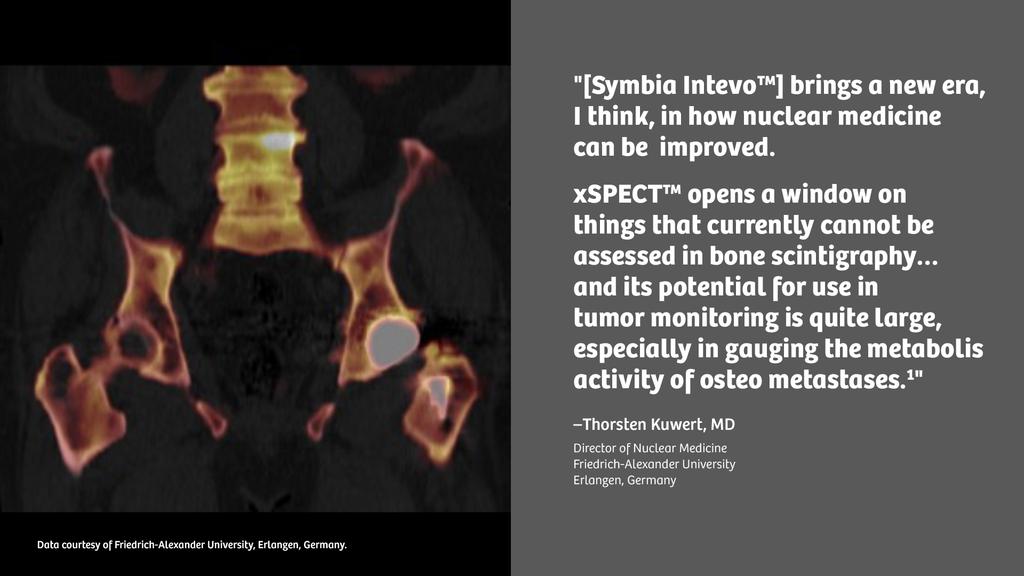 Moving SPECT/CT forward - Siemens Healthineers USA