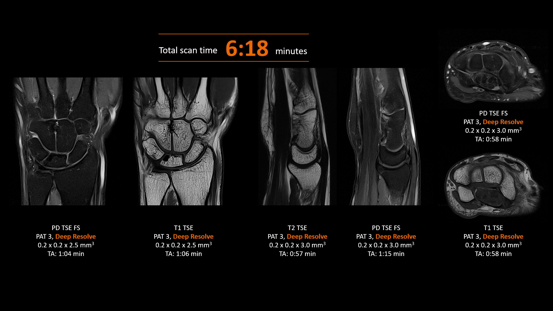 Musculoskeletal Imaging - Siemens Healthineers