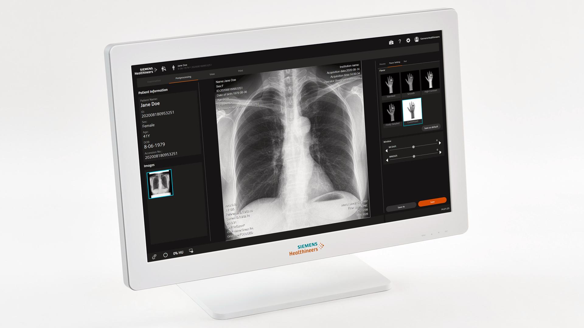 MULTIX Impact with myExam Companion - Siemens Healthineers
