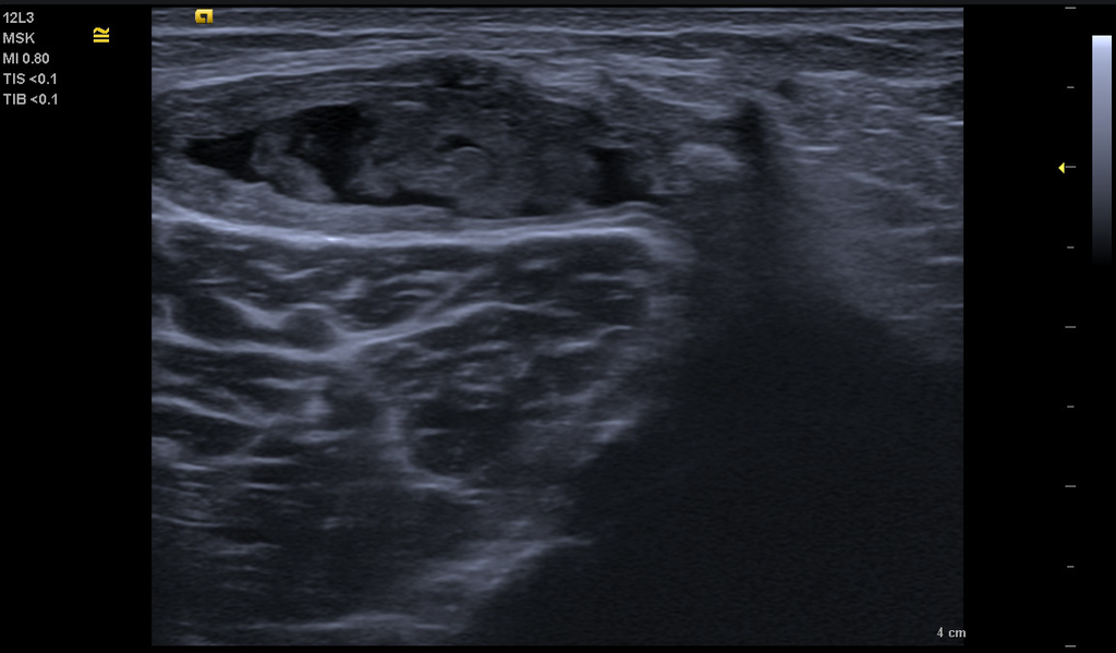 MSK Ultrasound