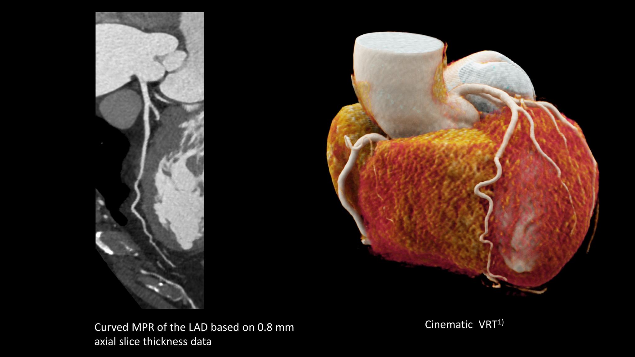 SOMATOM go.All – Made to match - Siemens Healthineers
