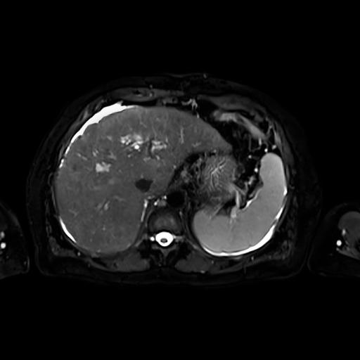 Phoenix Images for MAGNETOM Sola 1.5T