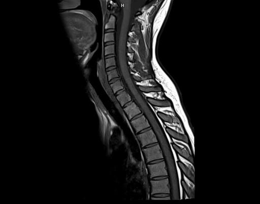 MAGNETOM Altea - Siemens Healthineers USA