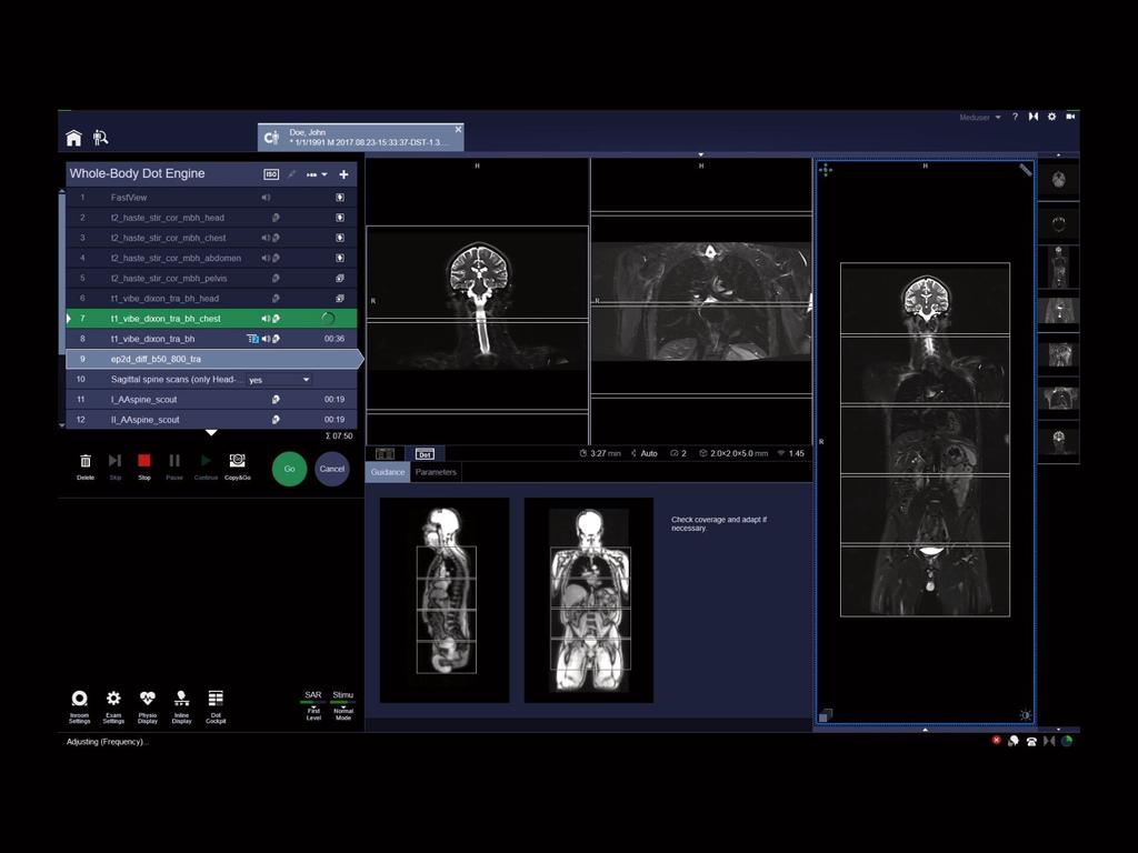 Magnetic Resonance Imaging - Clinical Software Applications - Siemens ...