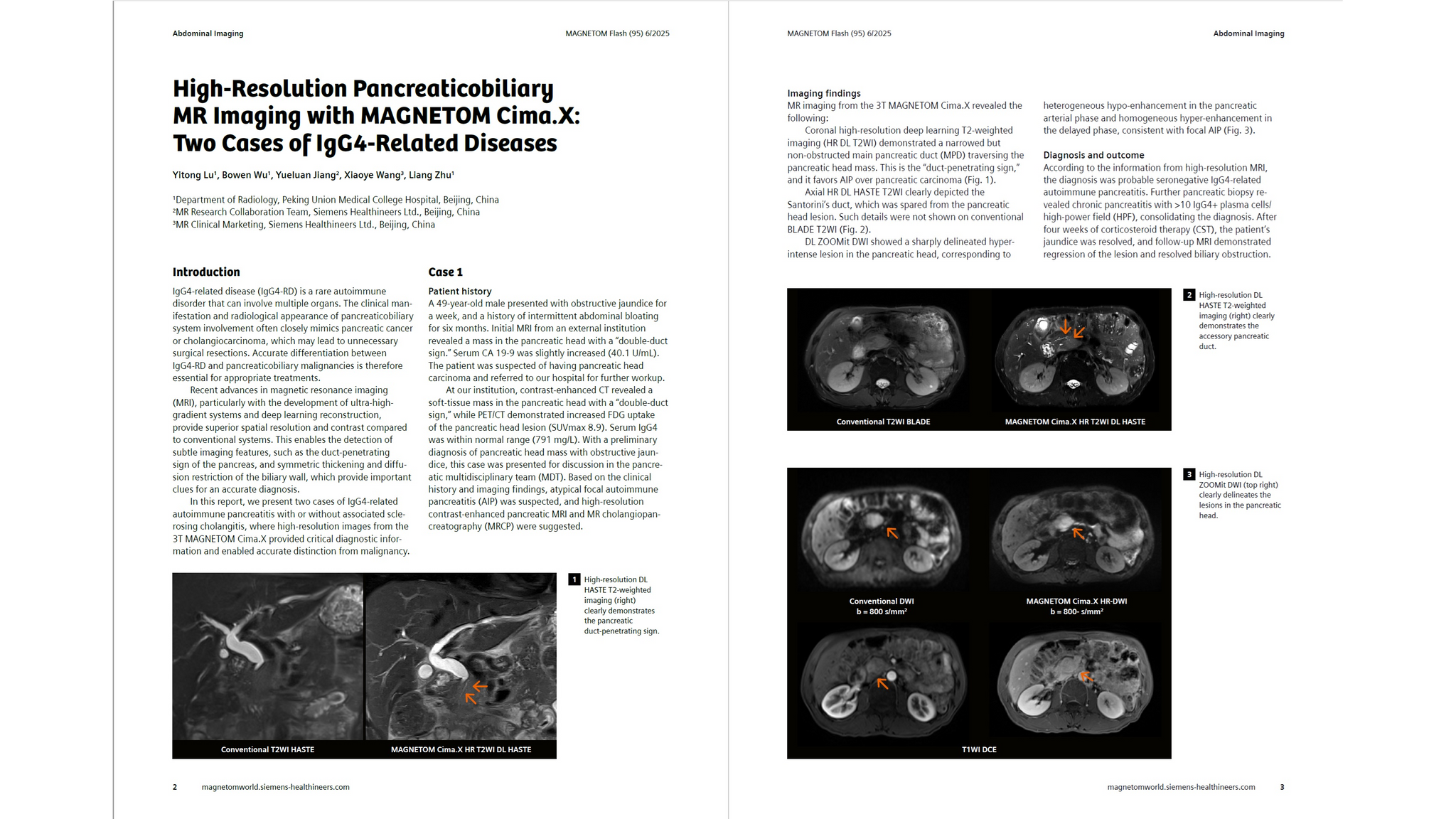 MRI Case Studies, MRI Case Study, MRI Case