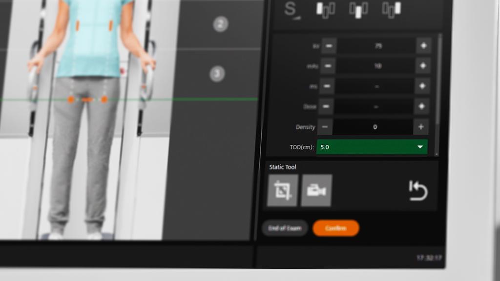 MULTIX Impact with myExam Companion - Siemens Healthineers