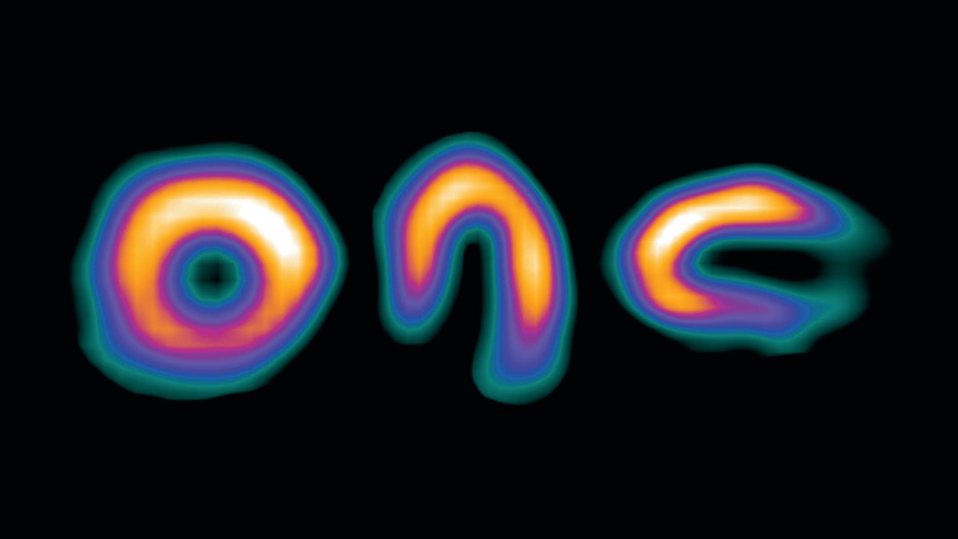 IQ•SPECT - The Art Of Minimizing Dose While Maximizing Speed - Siemens ...