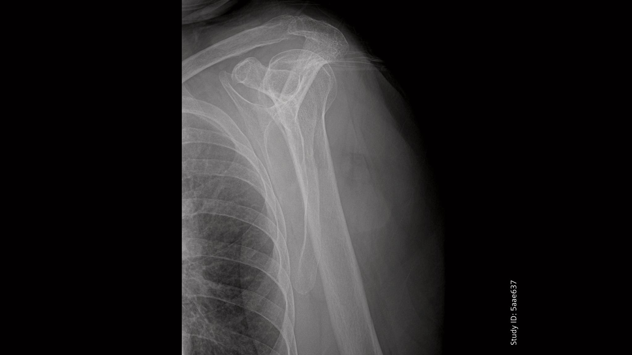 MOBILETT Impact - Siemens Healthineers