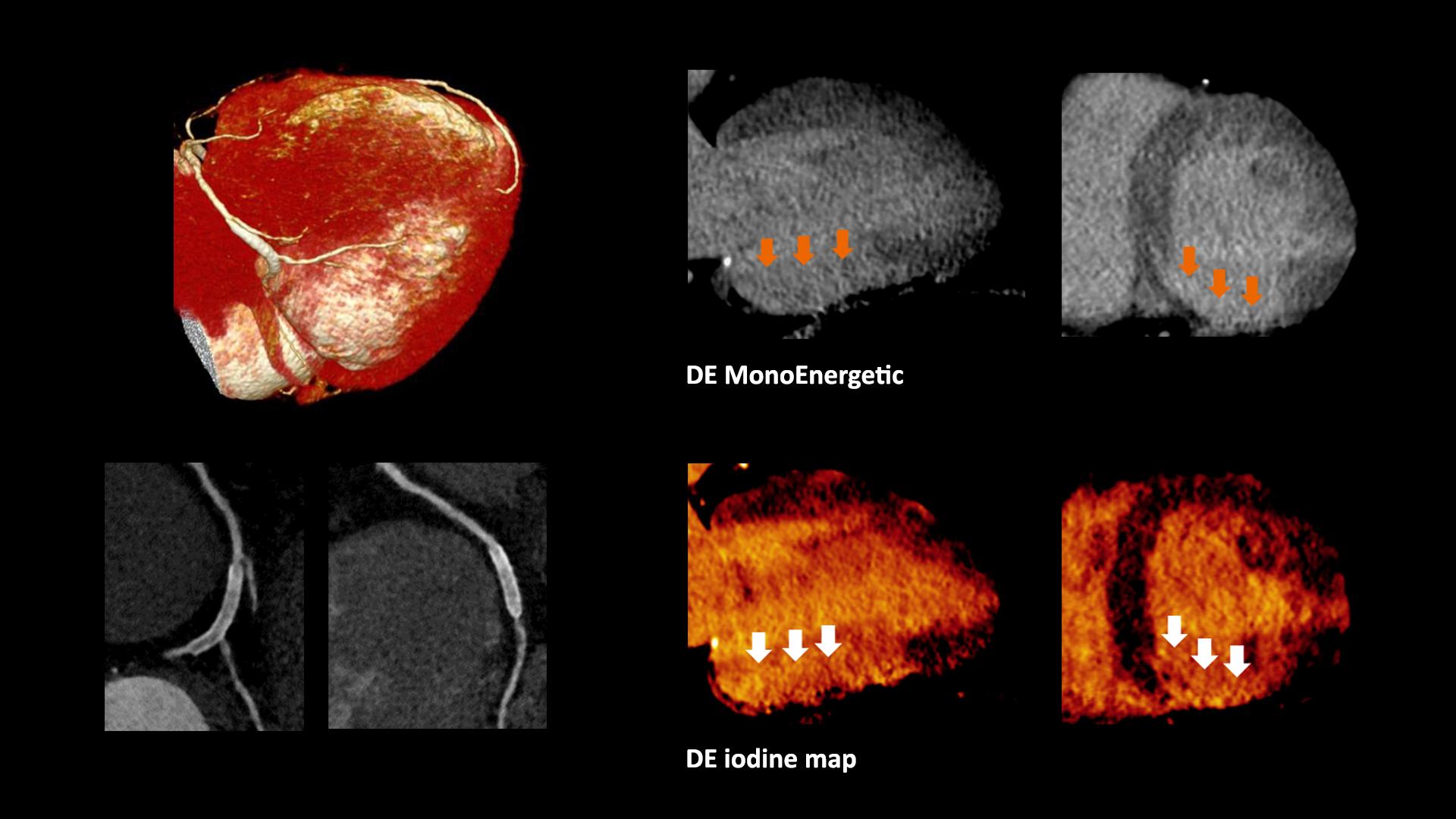 SOMATOM Drive - Siemens Healthineers USA