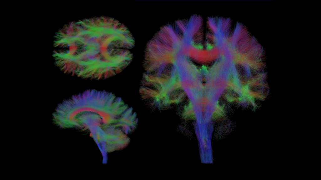 MR imaging in sports medicine - Siemens Healthineers