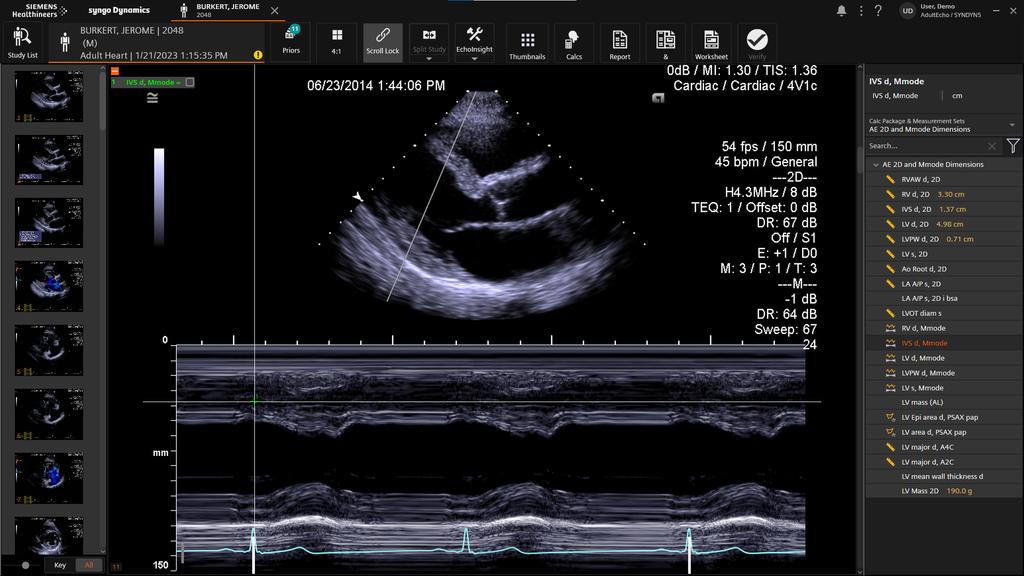 What Would Happen if You Could Better Manage Cardiovascular Imaging ...
