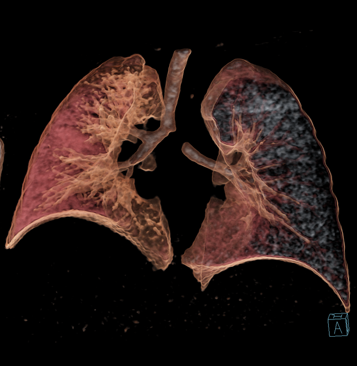 Pediatric - Computed Tomography - Siemens Healthineers USA