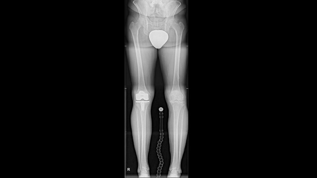 Twin Robotic X-ray scanner – Multitom Rax - Siemens Healthineers