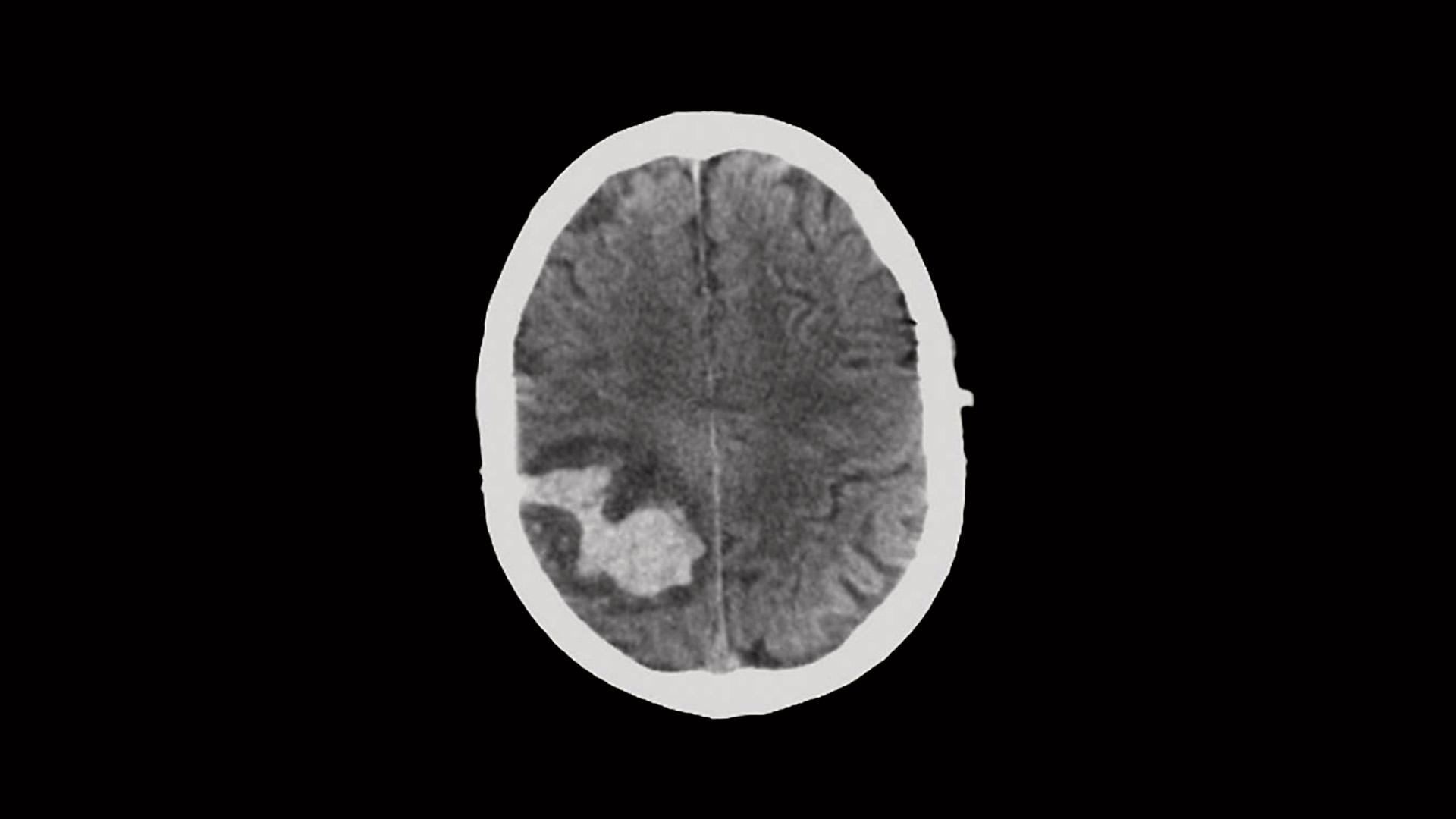 Artis Q - Siemens Healthineers