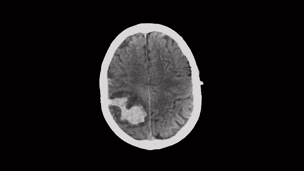 Artis Q - Siemens Healthineers