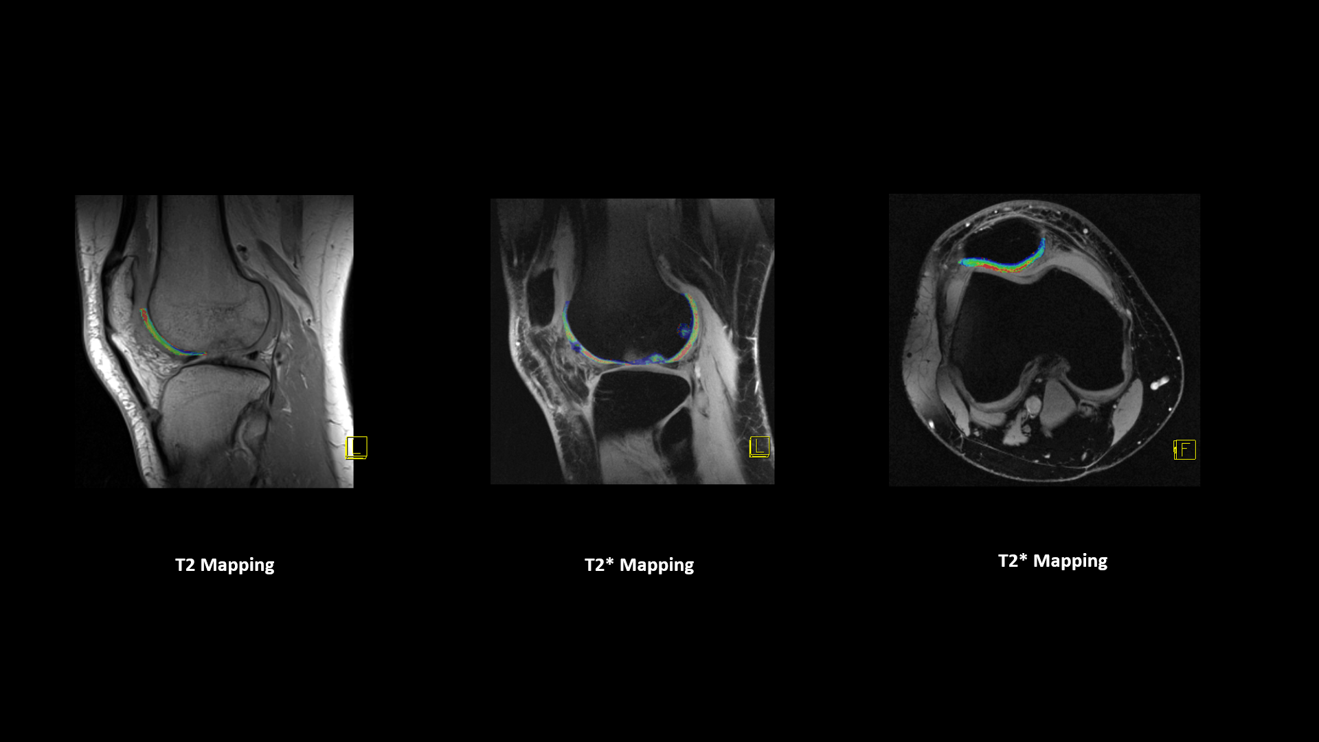 Musculoskeletal Imaging - Siemens Healthineers