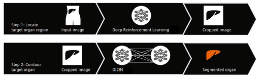 Automatic contouring with Organs RT