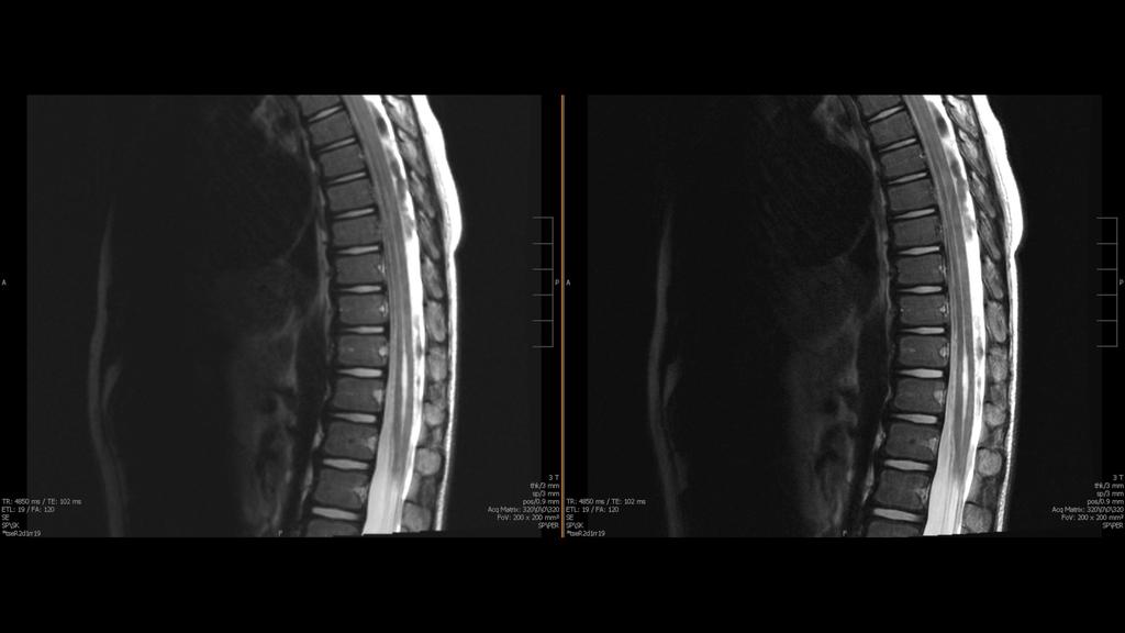 Pediatric protocols using Deep Resolve