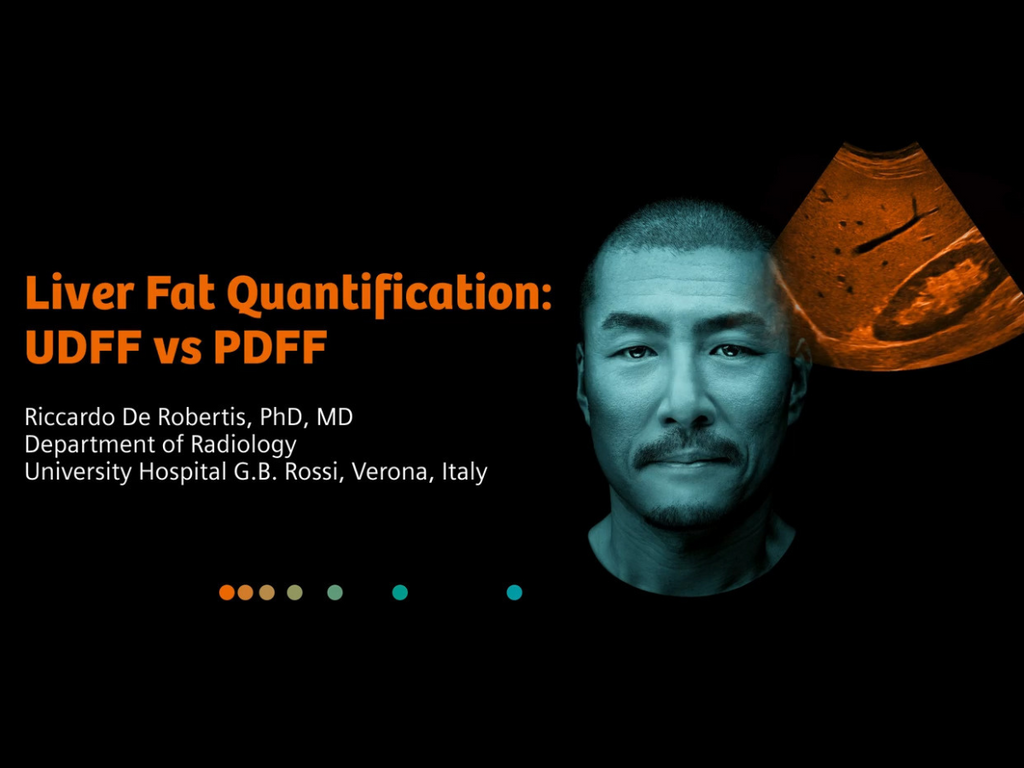 ACUSON Ultrasound Machines