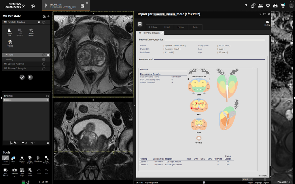 Mr Prostate Ai Based Segmentation And Classification