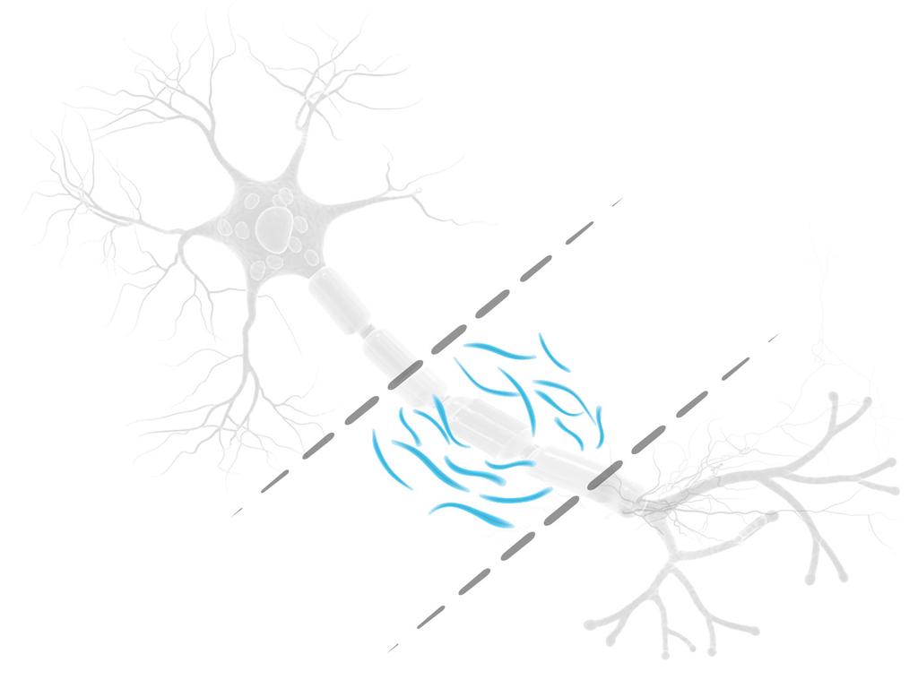 Neurofilament light chain (NfL) - Siemens Healthineers - Siemens ...