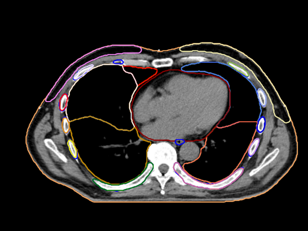 SOMATOM go.Sim - Siemens Healthineers