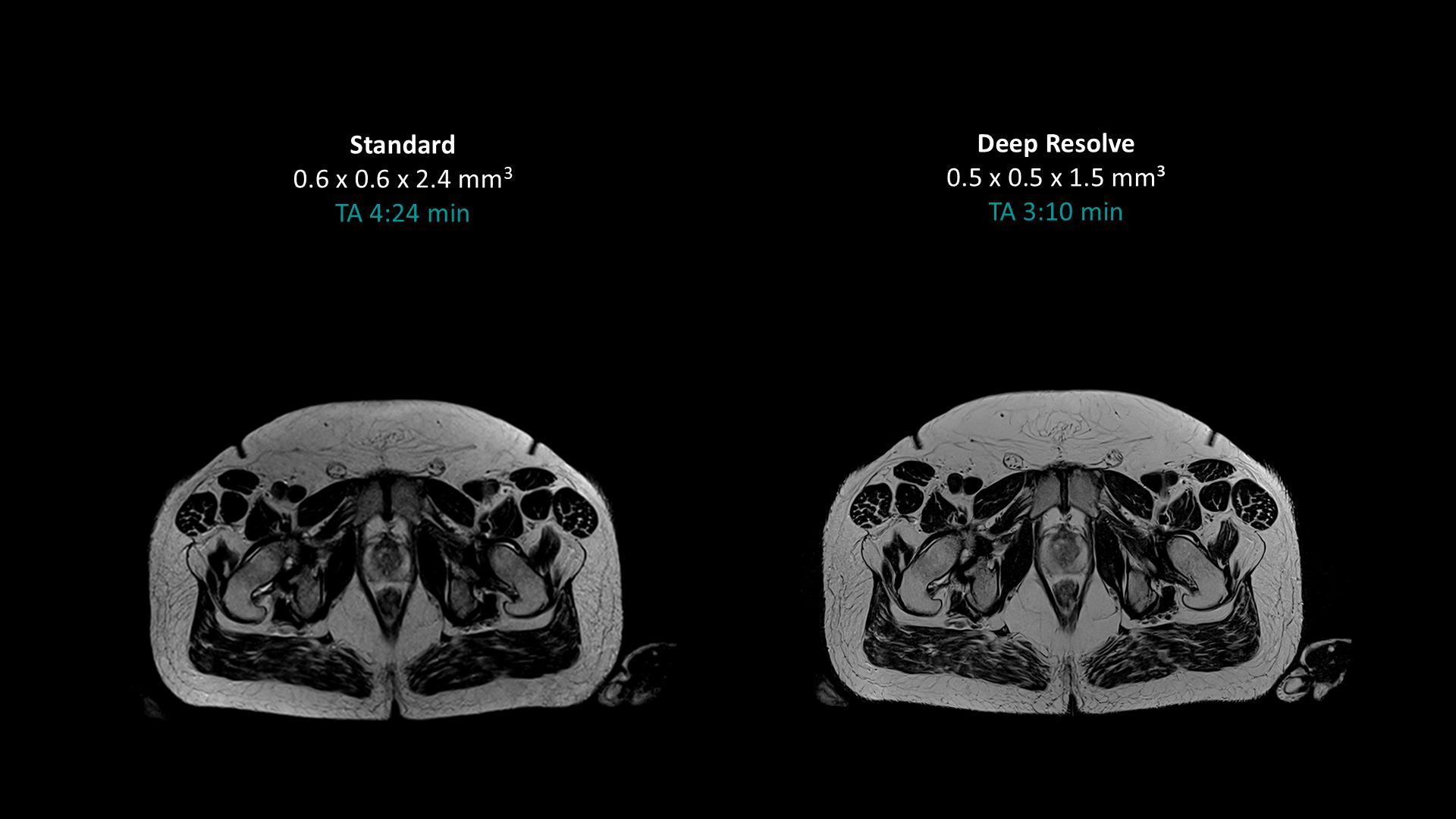 MAGNETOM Flow RT Pro Edition - Siemens Healthineers