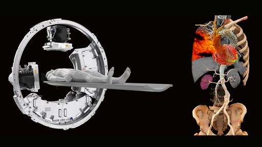 CT Dual Energy in daily practice - Siemens Healthineers Finland