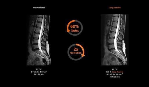 MAGNETOM Avanto Fit - Siemens Healthineers