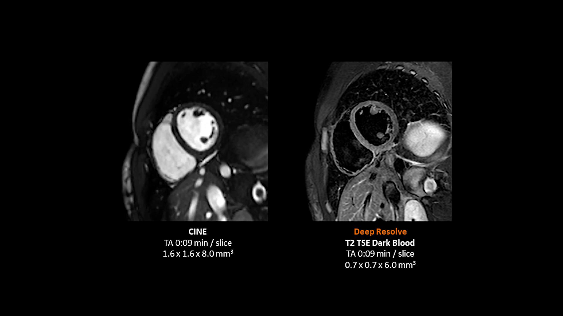 MAGNETOM Flow. Platform - Siemens Healthineers