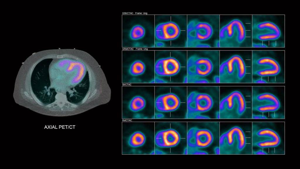 PETNET on cardiology - Siemens Healthineers USA