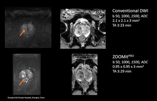 ZOOMitPRO - Siemens Healthineers