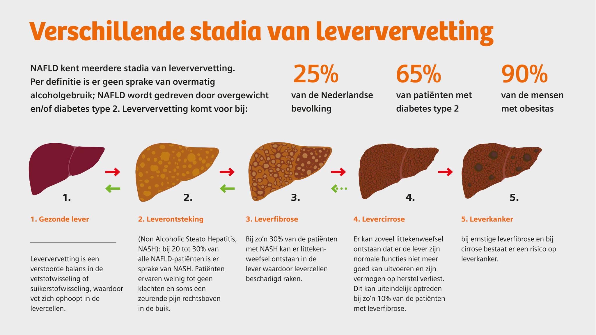 “NAFLD is géén onschuldig verschijnsel” Siemens Healthineers Nederland