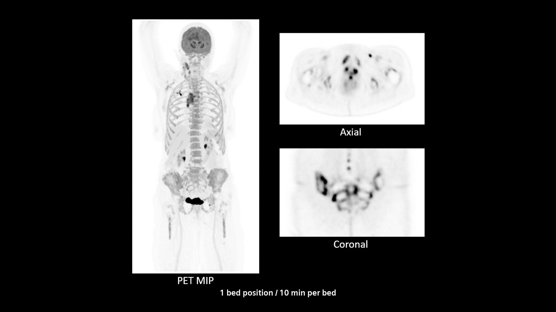Biograph Vision Quadra PET/CT Scanner - Siemens Healthineers