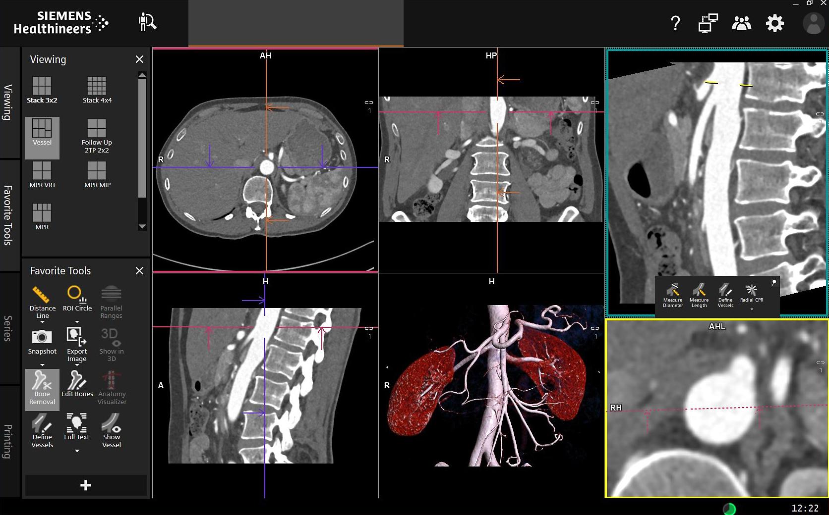 CT Scanner SOMATOM go.Top with myExam Companion - Siemens Healthineers USA