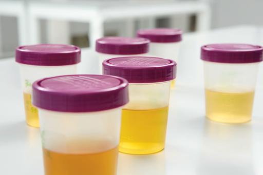 Specialty Urine Testing - Siemens Healthineers