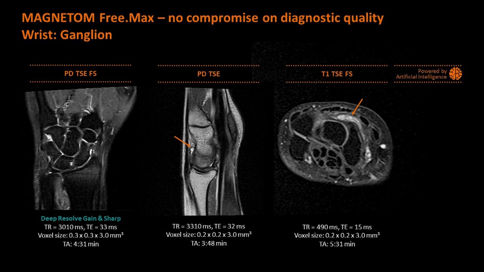 MAGNETOM Free.Star - Siemens Healthineers Japan