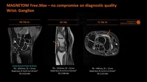 MAGNETOM Free.Max–wide bore mri - Siemens Healthineers Japan