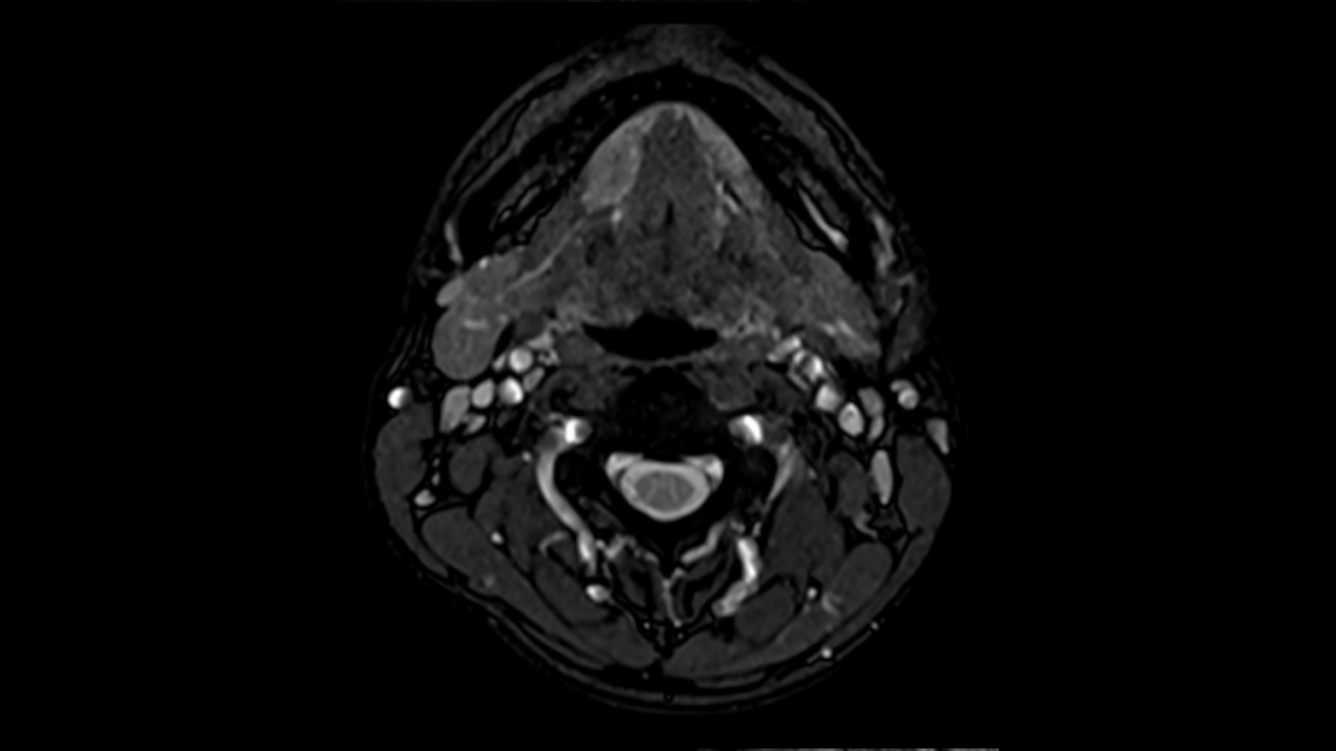 MAGNETOM Free.Star - Siemens Healthineers USA