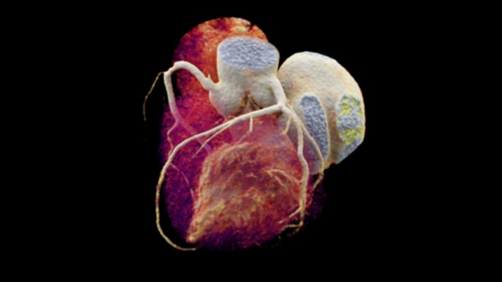 Medical Imaging - Siemens Healthineers