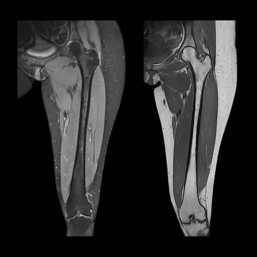 BioMatrix Technology - Siemens Healthineers USA