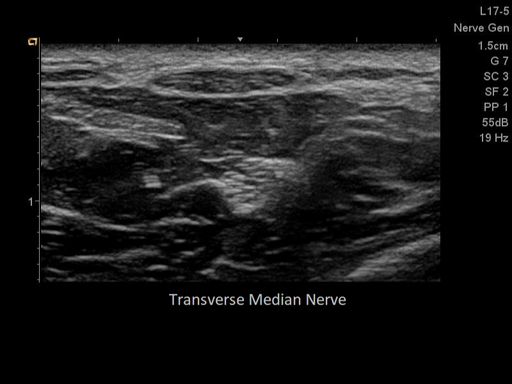 ACUSON Freestyle Wireless Ultrasound System - Siemens Healthineers