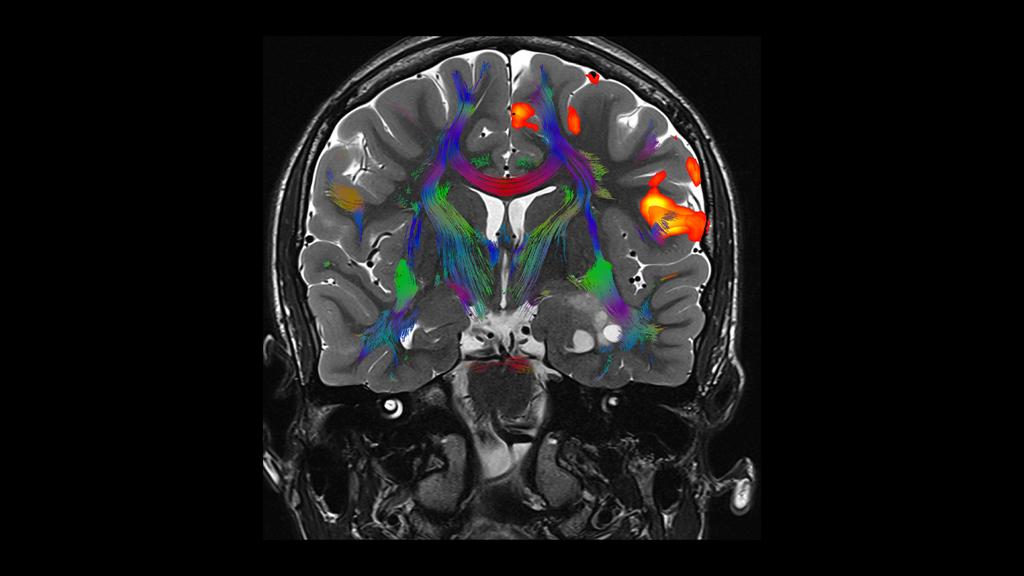 MAGNETOM Cima.X - Make the difference. - Siemens Healthineers