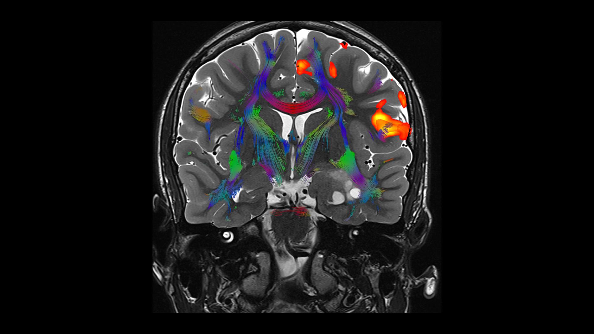 MAGNETOM Cima.X - Make the difference. - Siemens Healthineers