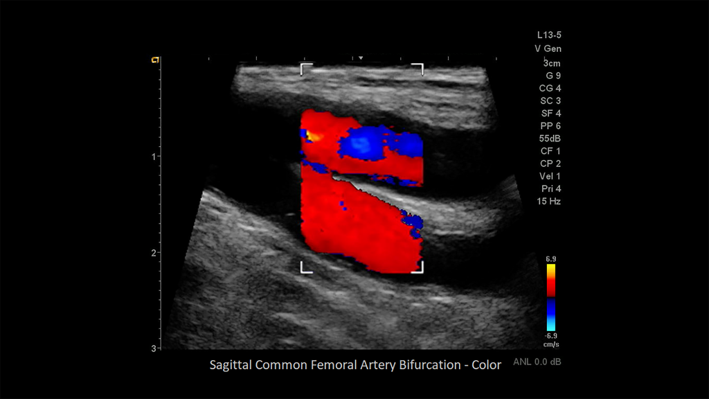 Wireless Ultrasound System | ACUSON Freestyle - Siemens Healthineers