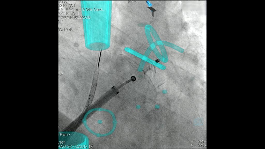 Cardiology Solutions